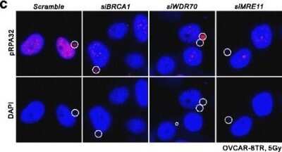 RPA2 [p Ser33] Antibody (NB100-544): Novus Biologicals